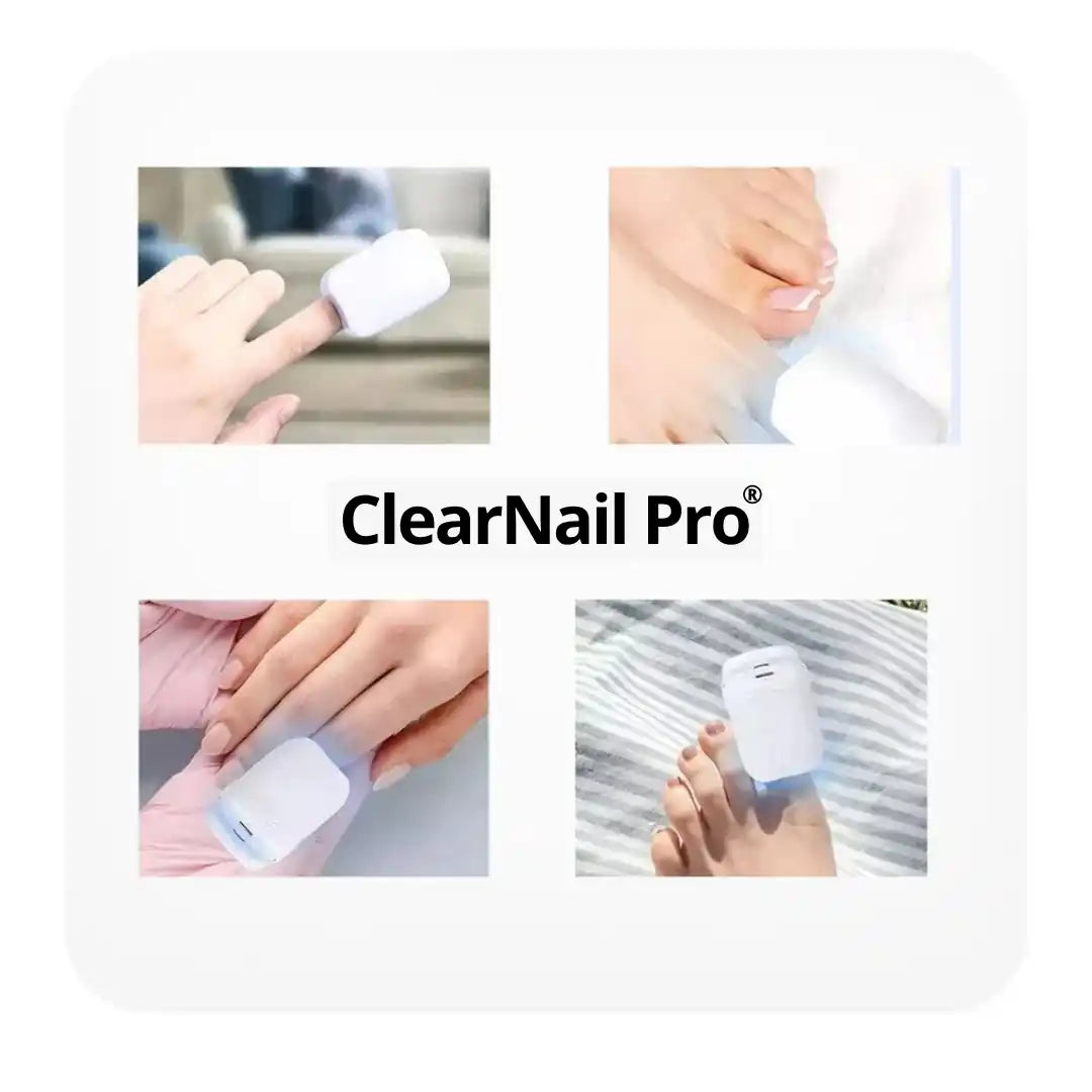 ClearNail Pro® Dispositivo láser para tratamiento de hongos en las uña ...